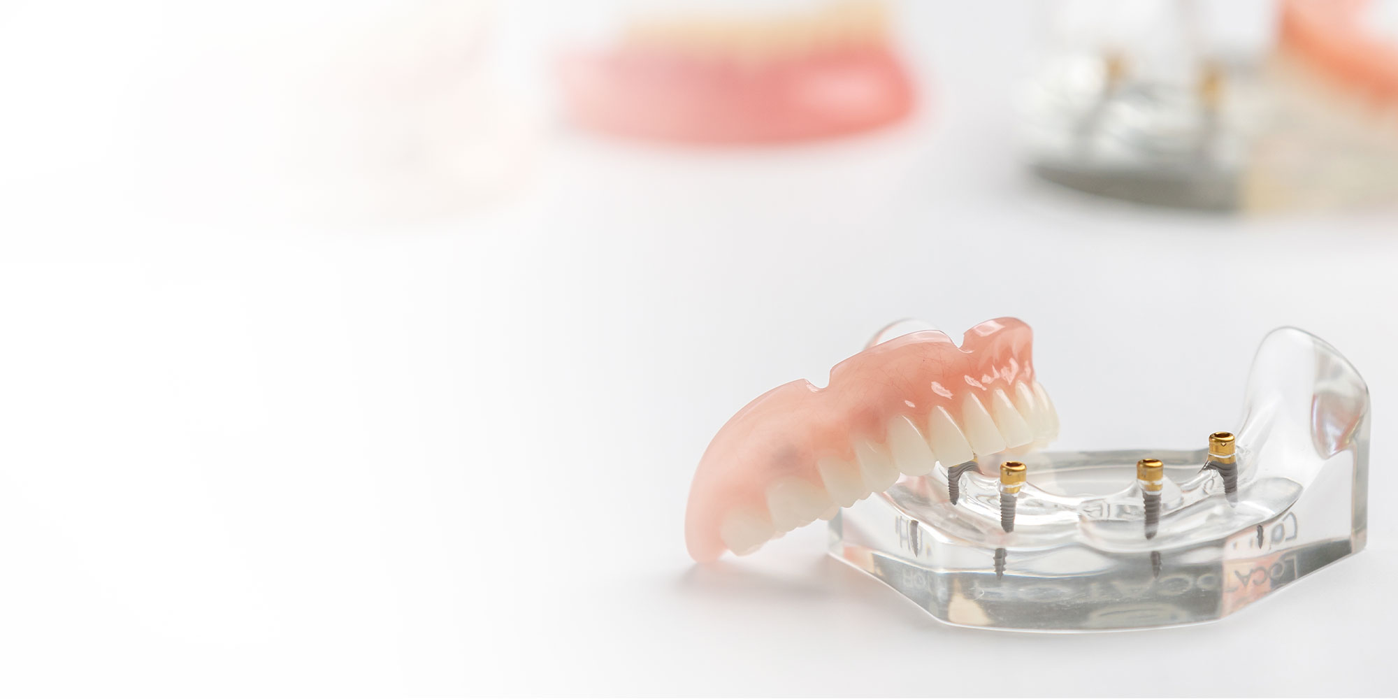 Fixed vs. Removable Teeth | Which Is Right for You? | J.P ...